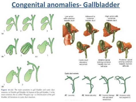 Biliary Tract Imaging Final