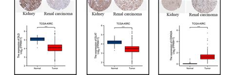 Independent Prognostic Analysis And Validation Of The Effect Of
