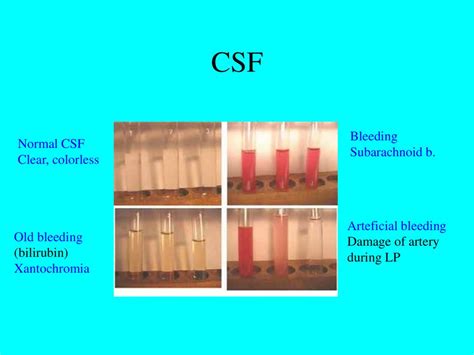 Cerebrospinal Fluid Csf Ppt Download