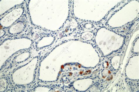 Normal Thyroid Gland Light Micrograph Stock Image C059 2690 Science Photo Library