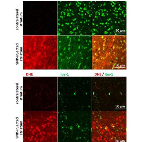 The Snp Injected Brain Slice With Immunohistochemical Staining Under A
