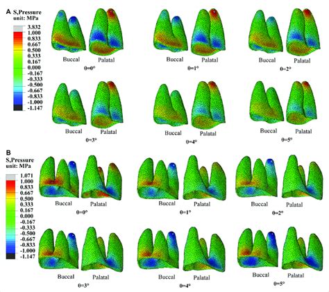 The Equivalent Stress Of Pdl With Different Torque Compensation A