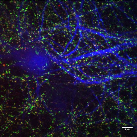 What Is Super Resolution Microscopy Sted Sim And Storm Explained