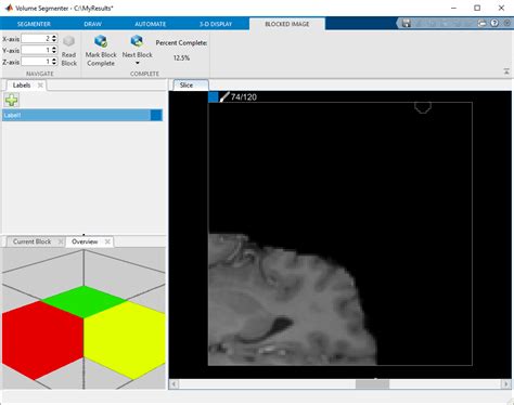 Work With Blocked Images Using Volume Segmenter Matlab And Simulink