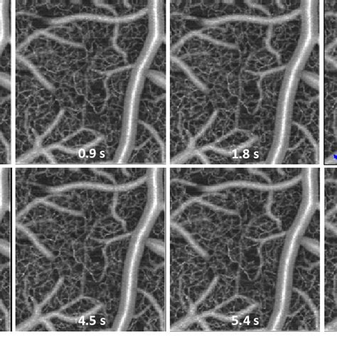 OCT Angiography Scanning Protocols A Three Dimensional Scanning Download Scientific Diagram