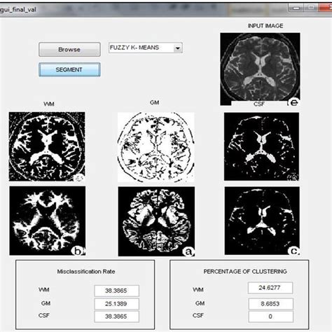 Gui For Segmentation Of Brain Using K Means For K3 Download