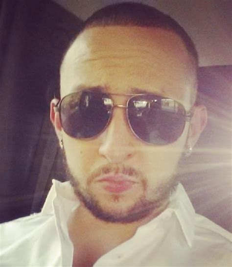 Progress Photos Hmr 35 Month Update Rhairtransplants