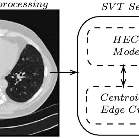 Segmentation Model Of Ct Image Download Scientific Diagram