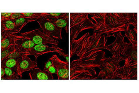 c Myc D C Rabbit mAb CST 优宁维 univ 商城