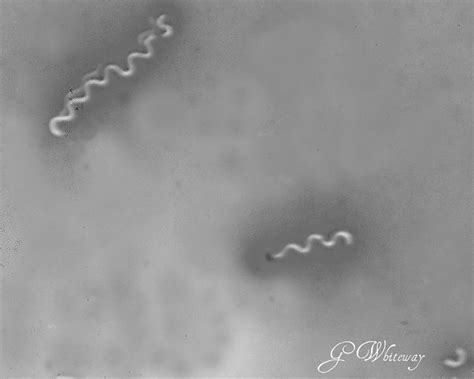 Syphilis Bacteria Shape