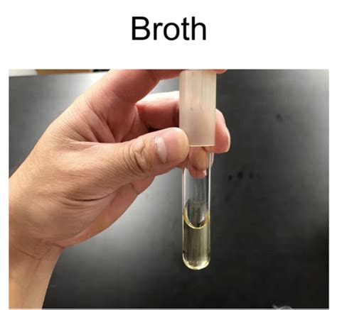 Aseptic Technique Flashcards Quizlet