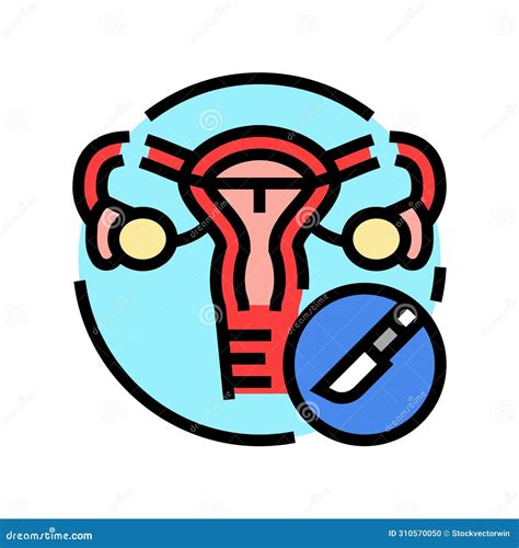 Tubal Ligation Surgery Color Icon Vector Illustration Stock Vector Illustration Of Breast