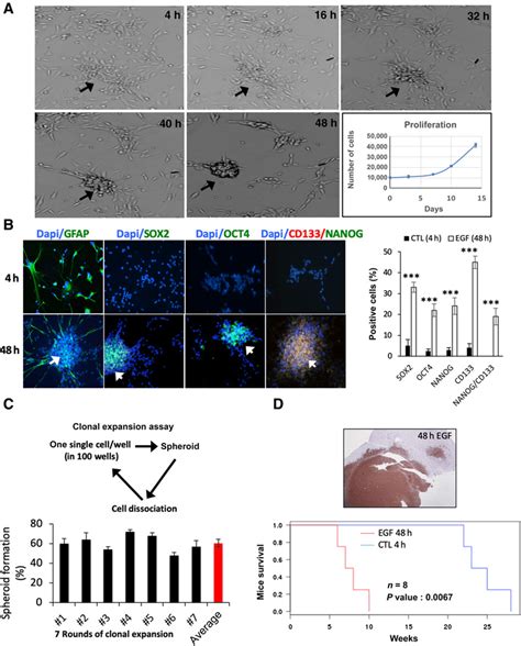 Differentiated GBM Cells Freshly Dissociated From Human GBM Resection Download Scientific