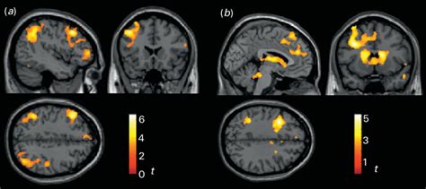 Correlation Of Brain Activation With Task Related Anxiety Ratings A Download Scientific