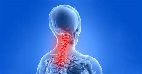 Prescott Cervicogenic Headache Treatment Prescott Az Chiropractor