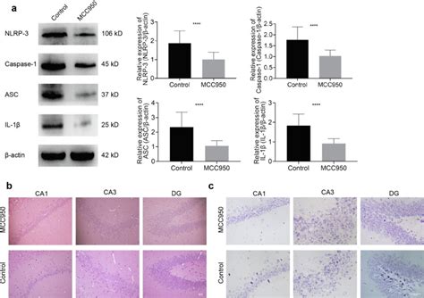 Nlrp3 Inflammasome Regulates Astrocyte Transformation In Brain Injury