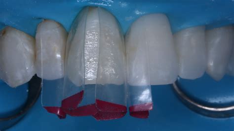 Upcoming Cpd Adawa Cpd