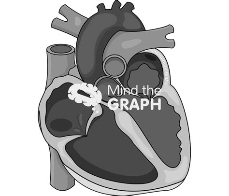 Free Atrial Functional Mitral Regurgitation Combined Hfpef Fraction Atrial Fibrillation Icons