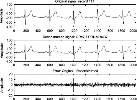 figure 9 from embedded filter bank based algorithm for ecg compression semantic scholar