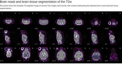 Results Of Fmriprep Rodents Software Support Neurostars