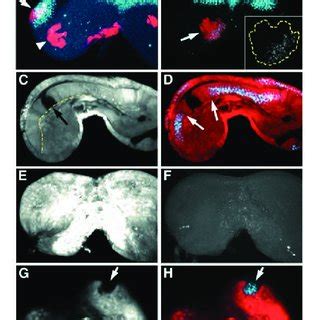 The Sex Determination Pathway Determines Dac Regulation Confocal