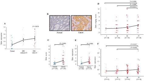 Figure 1 From Successful Identification Of A Predictive Biomarker For Lymph Node Metastasis In