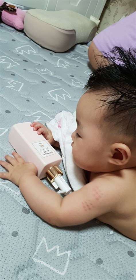 임산부 튼살 없애는법 몽디에스 마더투비 멀티 튼살 오일 신생아 아기 베이비 오일 로도 좋아 네이버 블로그