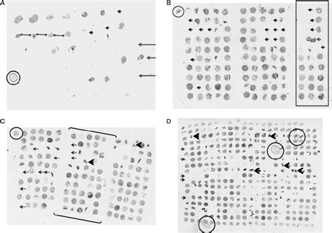 Examples Of Suboptimally Constructed Tissue Microarrays Tmas And Download Scientific Diagram