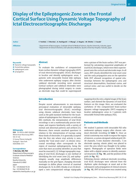 Pdf Display Of The Epileptogenic Zone On The Frontal Cortical Surface Using Dynamic Voltage
