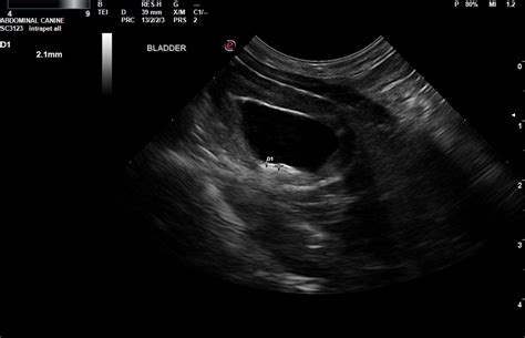 Interstitial Cystitis With Embedded Mineralization In A 7 Year Old Fs
