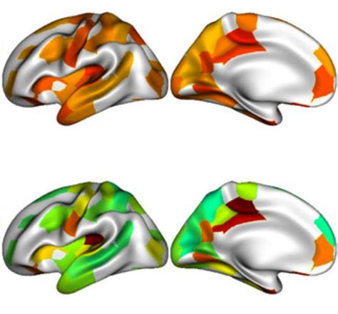 New Paper In Cerebral Cortex Meca Research Group