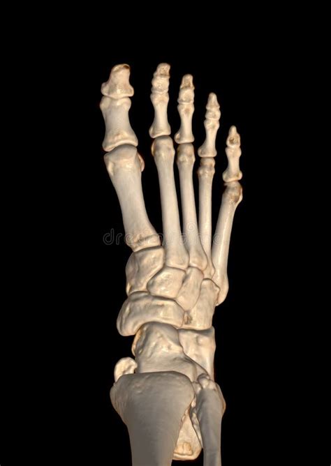 Ct Scan Ankle And Foot Stock Illustration Illustration Of Arthritis