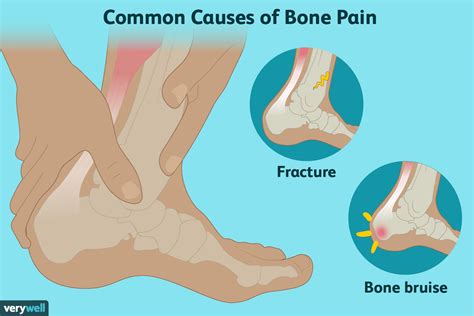 What Does A Bone Fracture Feel Like Signs Your Broken Bone Is Healing
