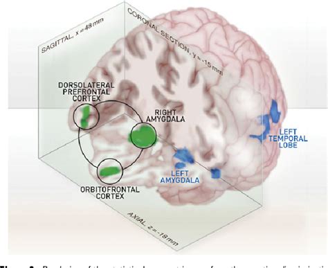 Orbitofrontal Cortex And Amygdala