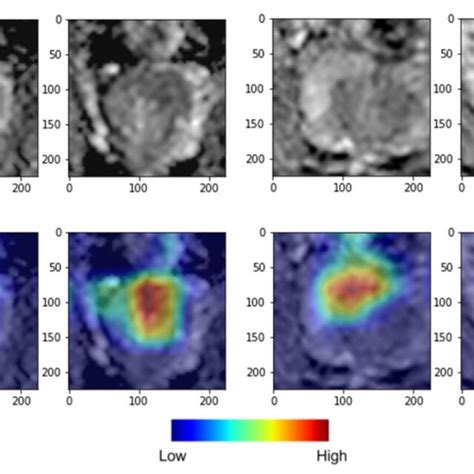 Deep Learning Dl Gradient Weighted Class Activation Mapping Download Scientific Diagram