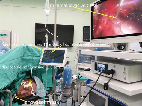 Operative Views Of A Patient Undergoing Nonintubated Minimally Invasive Download Scientific