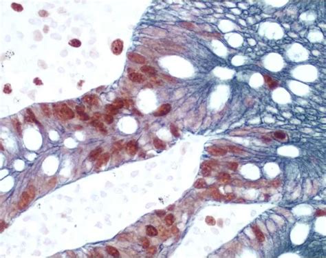 Hrp Substrates Vector Novared Peroxidase Substrate