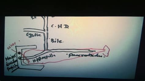 Pancreas Flashcards Quizlet