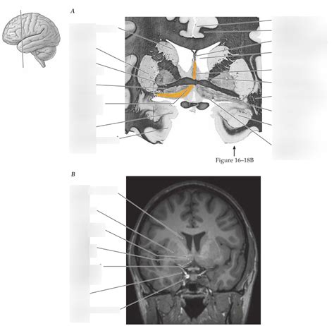 Diagram Of Fig 16 12 Myelin Stained Coronal Section Through The