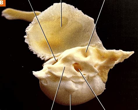 Right Temporal Medial View Diagram Quizlet