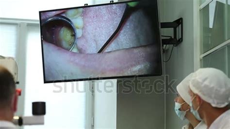 Root Canal Part ThisVid