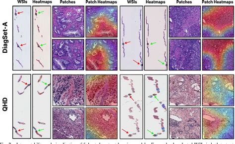 Figure 2 From Biomedical Signal Processing And Control Semantic Scholar