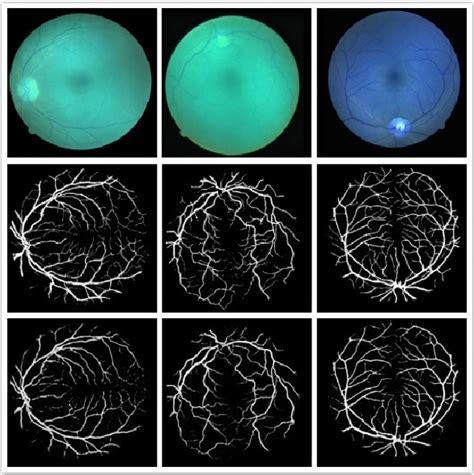 Figure 1 From Multi Scale Feedback Feature Refinement U Net For Medical Image Segmentation