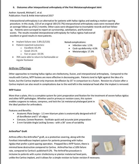 Say No To A Big Toe Fusion