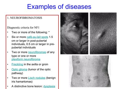 modes of inheritance ppt