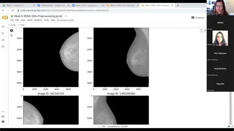 Nghi Huynh On Linkedin Week 2 Tutorial Deep Learning Fundamentals For Image Processing