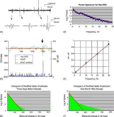 Basis For Unsupervised Interictal Spike Detection A This Illustrates