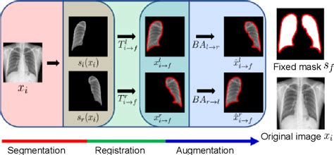 Figure 1 From Improved Generative Model For Weakly Supervised Chest