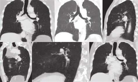 Representative Minip Images Showing The Various Level Of Sectioning Of Download Scientific