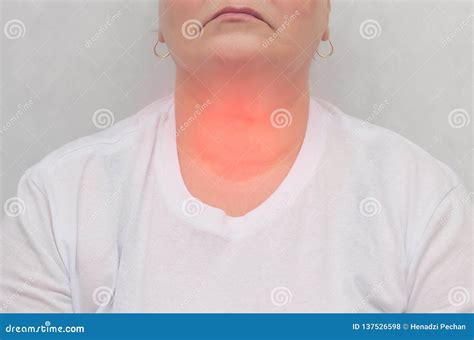 Adult Woman On A White Background Which Has A Thyroid Gland Nodes In The Thyroid Gland Close